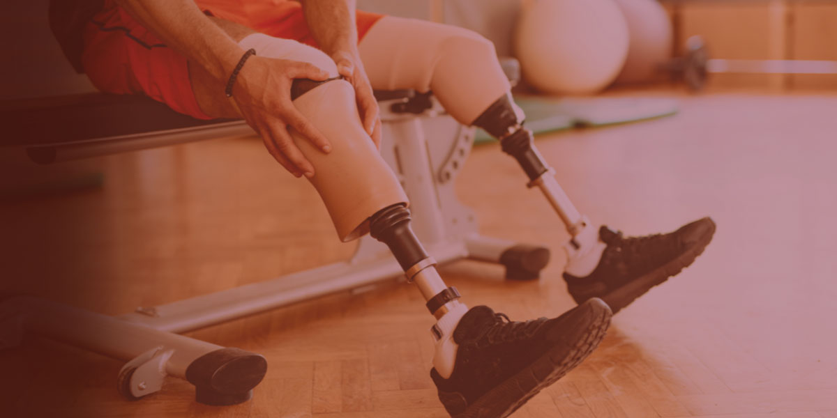 The Polymers Powering Prosthetic Fabrication - Total Plastics