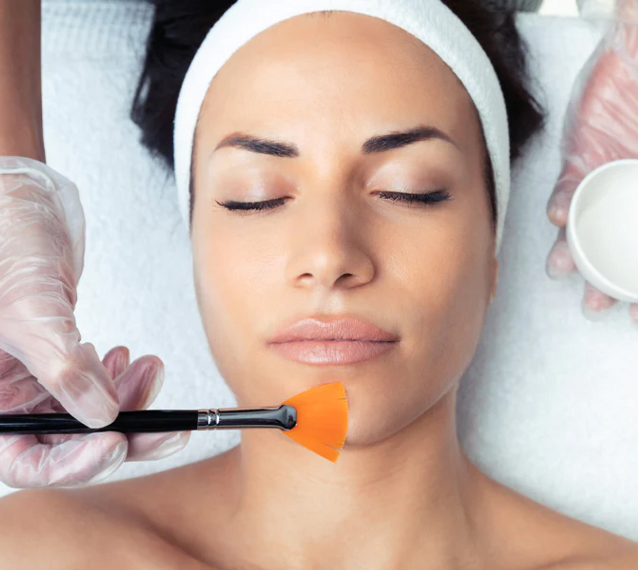 Chemical Peels Chemical Peels