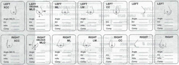 Mammography Labels, easy to read | Eljay X-Ray, Inc.