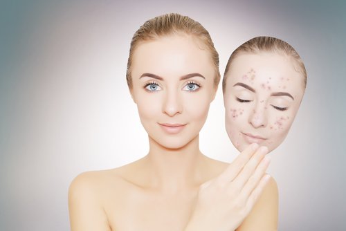 6 Types Of Skin Pigmentations You Need To Know - Numbskin Cream