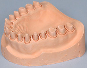 Gresco Dental Lab Stone - High Density - Buff Regular Set - 20 Kg