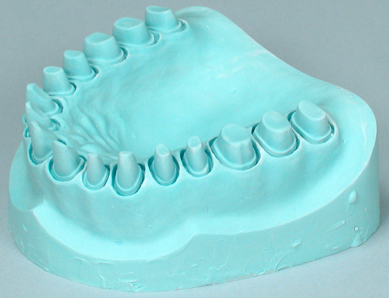 Gresco Dental Die Stone - Aqua - 20 Kg