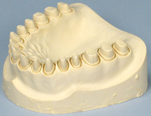 Gresco Dental Lab Stone - High Density - Buff Faster Set - 20 Kg