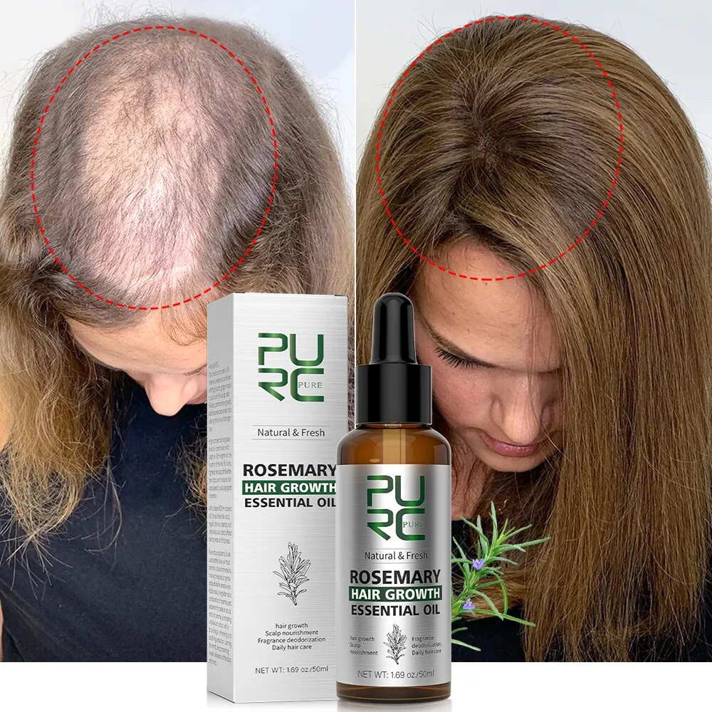 Transform Your Hair with Rosemary Essential Oil for Hair Growth