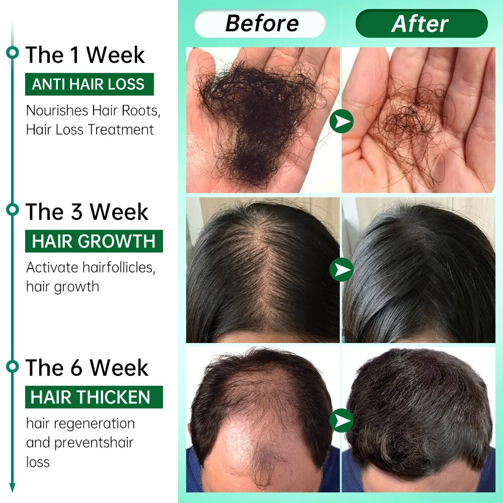 Transform Your Hair with Rosemary Essential Oil for Hair Growth