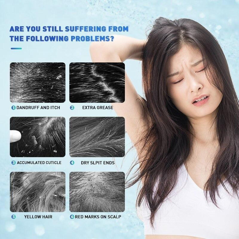 Say Goodbye to Dandruff with Anti-Dandruff Kit (Spray 60ml + Cleaning ...