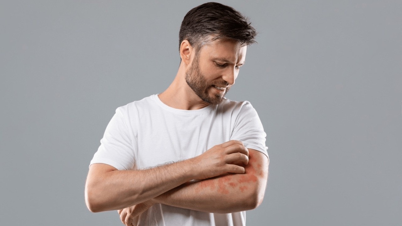 Common Adult Skin Conditions & How To Deal With Them Effectively ...