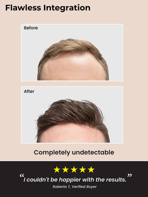 Mens Toupee FR111M V-loop Full Thin Skin Frontal Medium Hair Patch ...