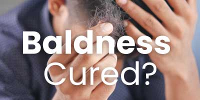 Cure for baldness? Researchers make breakthrough with hair follicle ...