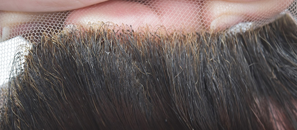 3 Major Things to Consider When Choosing a Hair System ...
