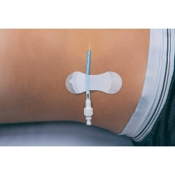 Catheter / Line Securement Device Grip-Lok® (1/EA) - Progressive ...