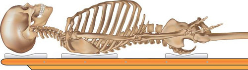 Laerdal PadPak Alignment Pads - 10 Pack | Live Action Safety