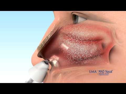 LMA Nasal Mucosal Atomization Device MAD140 | Live Action Safety