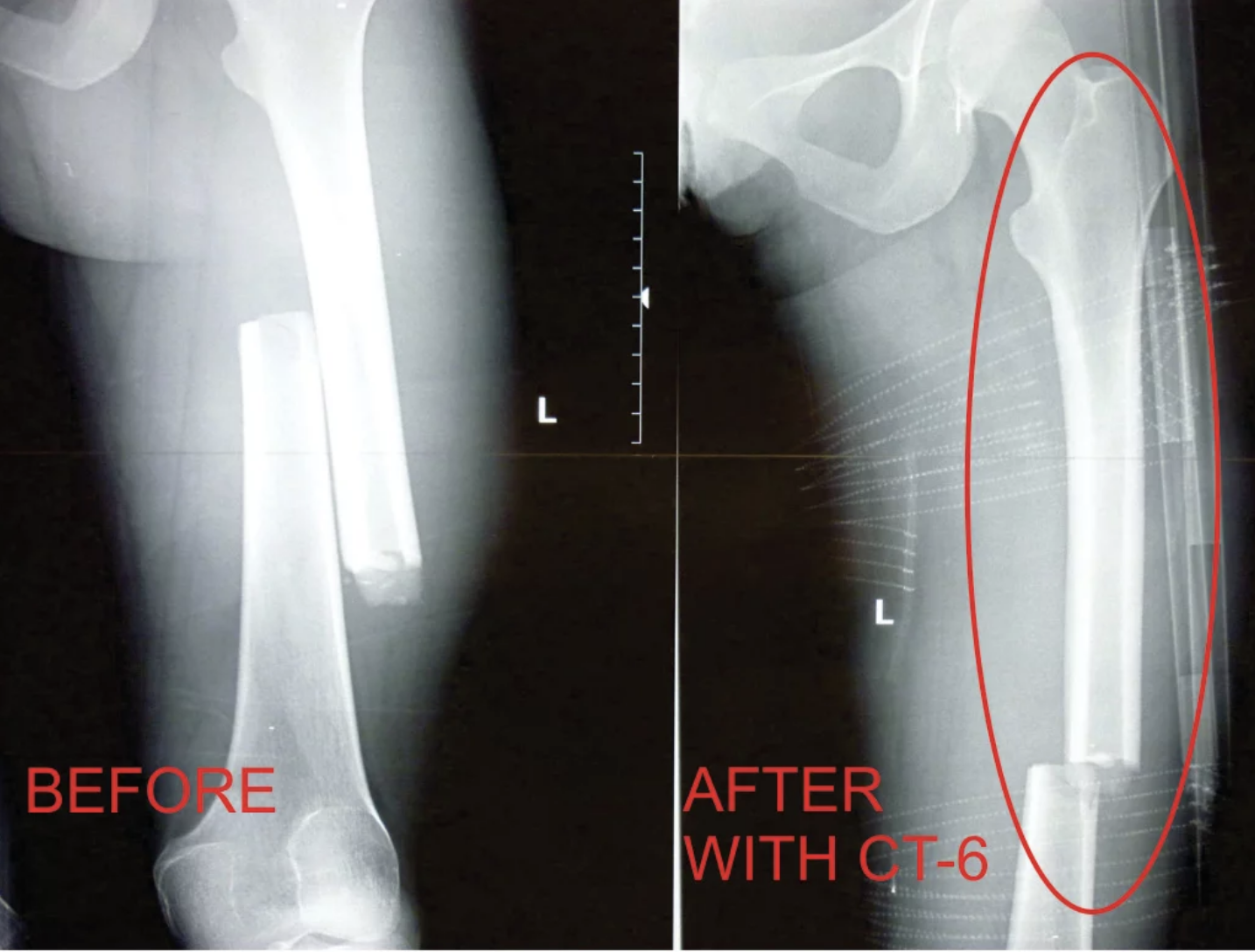 Faretec CT-EMS Leg Traction Device Splint | Live Action Safety