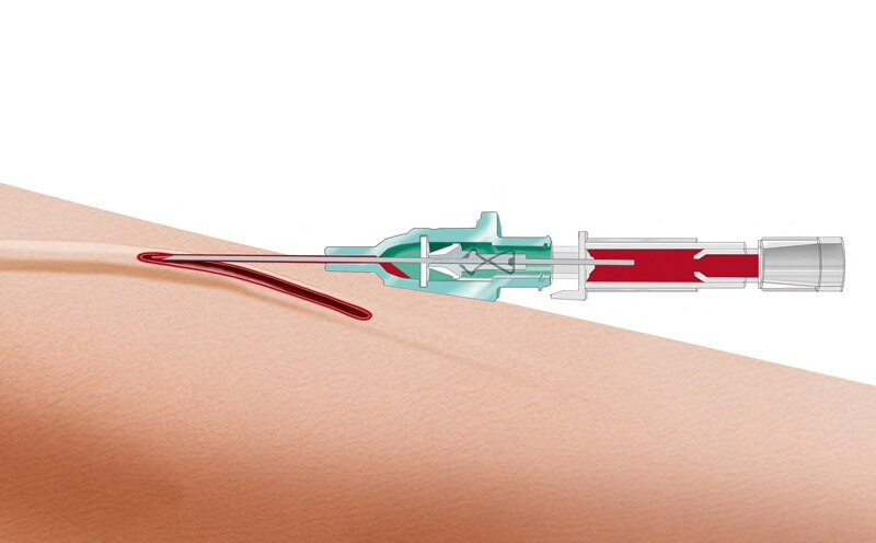 B Braun Introcan Protective IV Catheters - 22G X 1" | Live Action Safety