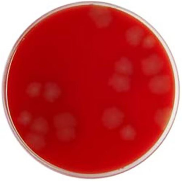 Fastidious Anaerobe Agar + 7% Defib Horse Blood Plates Pk 10 ...