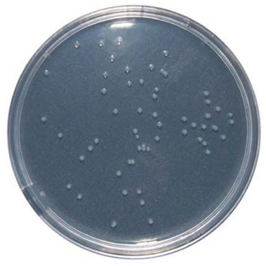 R2A Agar 90mm PP Plates Pk 10 - Trafalgar Scientific