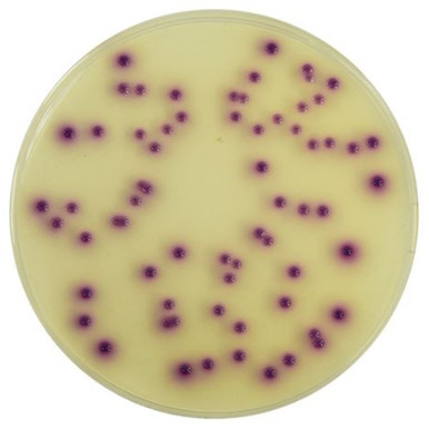 Colorex ESBL PP Plates Pk 10 - Trafalgar Scientific