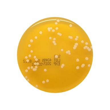 Sabouraud Dextrose Agar (SDA) 55mm Pre-Poured Contact Plates Pk 10 ...