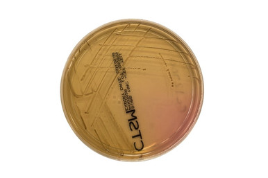 Sorbitol MacConkey Agar with Cefixime Tellurite 90mm Pk 10 - Trafalgar ...