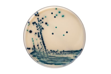 Brilliance™ ESBL Agar 90mm Plates Pk 10 - Trafalgar Scientific