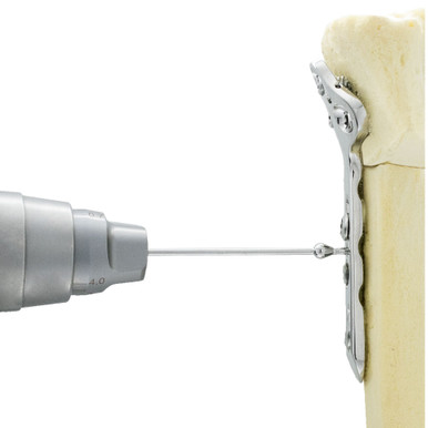 VOI STA-FIX Pin | STA-FIX PIN 0.062