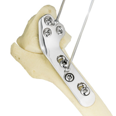 VOI STA-FIX Pin | STA-FIX PIN 0.062