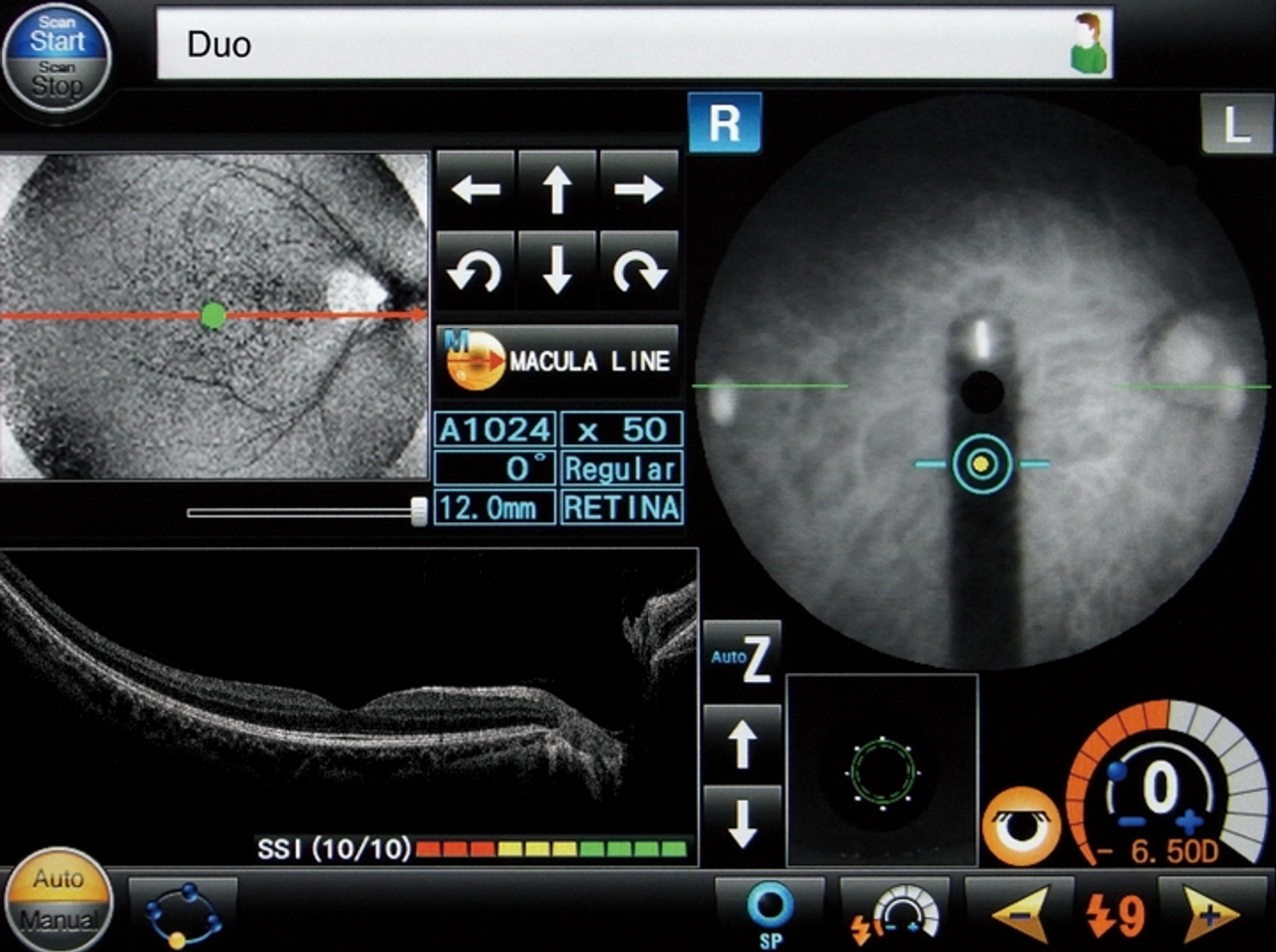 Nidek Optical Coherence Tomography / Fundus Camera Retina Scan Duo™2