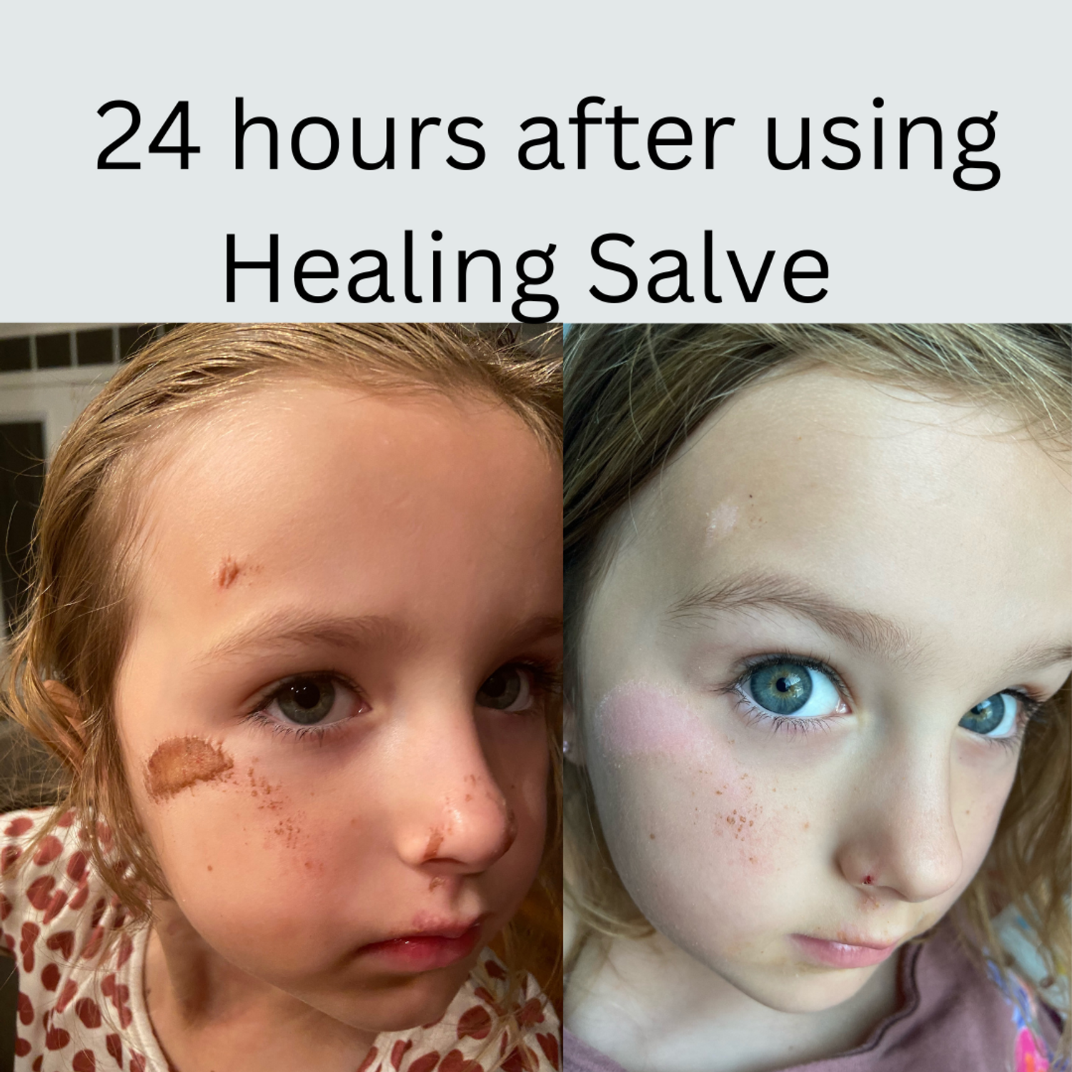Healing Salve 4 Ounce One Eighty Products