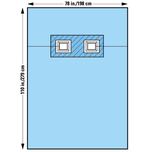 Halyard 78" x 110" Blue Non-Sterile PICC Drape with Side Perforations ...