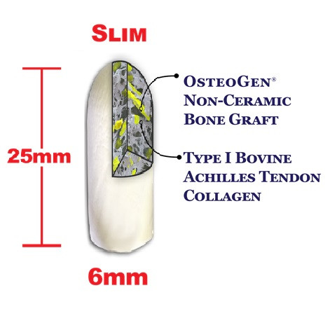 Impladent Slim 6mm x 25mm OsteoGen Plug (OPS625-25)
