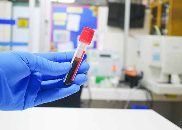 The 3 Most Common Applications for Headspace Vials - Chrom Tech, Inc.