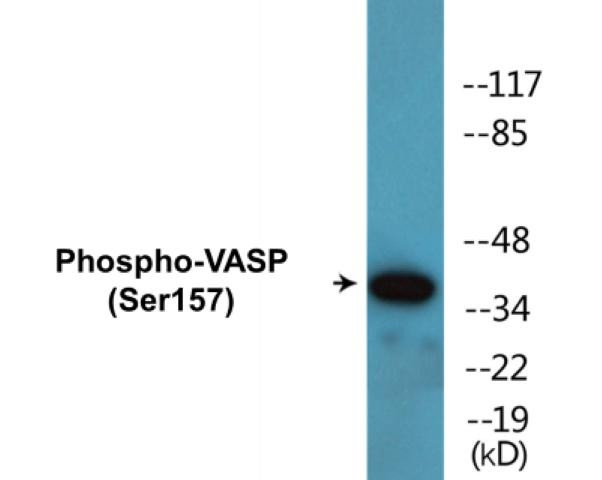 VASP (Phospho-Ser157)Colorimetric Cell-Based ELISA Kit (CBCAB01256)
