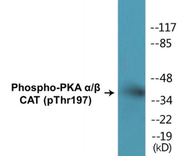PKA alpha/beta CAT (Phospho-Thr197)Colorimetric Cell-Based ELISA Kit ...