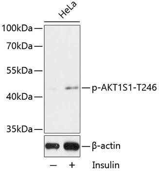 Phospho-AKT1S1/PRAS40-T246 Antibody (CABP0793)