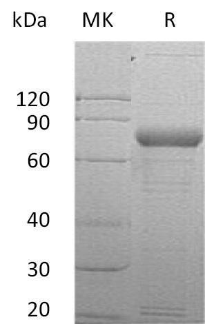 Human SIRP gamma/CD172g Recombinant Protein (His Tag) (Active) (RPES0679)