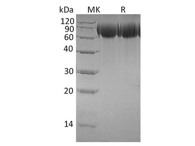 Human TrkB/NTRK2 Recombinant Protein (His Tag) (Active) (RPES0776)