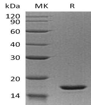 Human Interleukin-20/IL-20 Recombinant Protein (RPES2188)