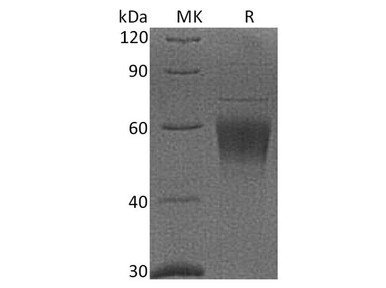 Cynomolgus CRTAM/CD355 Recombinant Protein (His Tag) (RPES2549)
