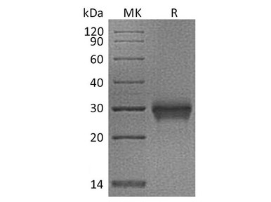 Cynomolgus CD40/TNFRSF5/CD40L receptor Recombinant Protein (His Tag ...
