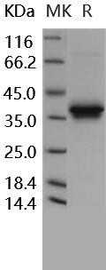 Human FN14/TWEAKR Recombinant Protein (Fc Tag) (Active) (RPES3276)