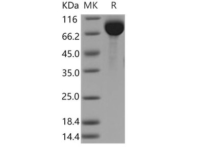 Human AFM/Afamin Recombinant Protein (His Tag) (RPES4276)