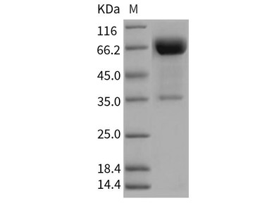 Rat OLR1/LOX1 Recombinant Protein (Fc Tag) (RPES4786)