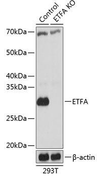[KO Validated] ETFA Antibody (CAB19937)