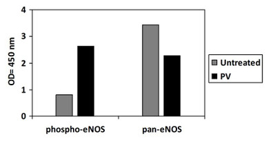 Human Phospho-eNOS (S1177) and Total eNOS PharmaGenie ELISA Kit (SBRS1804)