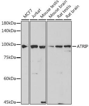 ATRIP Monoclonal Antibody (CAB19279)