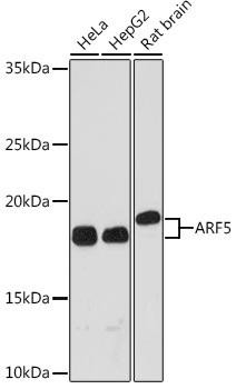 Anti-ARF5 Antibody | Suitable for WB IF | Highly Sensitive