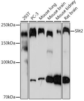 Anti-Slit2 Antibody | Suitable for WB IHC | Highly Sensitive