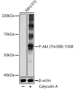 Anti-Phospho-Akt (Thr308) Antibody | Suitable for WB