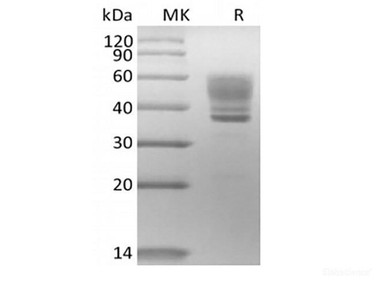 Recombinant Human Interleukin-13/IL-13 (C-mFc) | Assay Genie